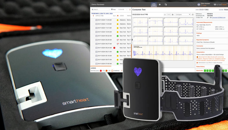 Shop SmartHeart® EKG Devices & Plans Online